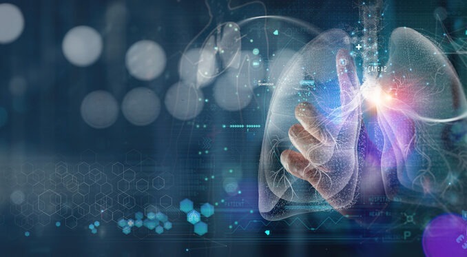 NEWS: NHS Tests AI and Robotics to Speed Up Lung Cancer Diagnosis ...